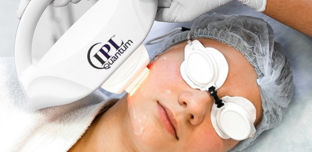 IPL Luz Pulsada Intensa , Piel Radiante y Renovada